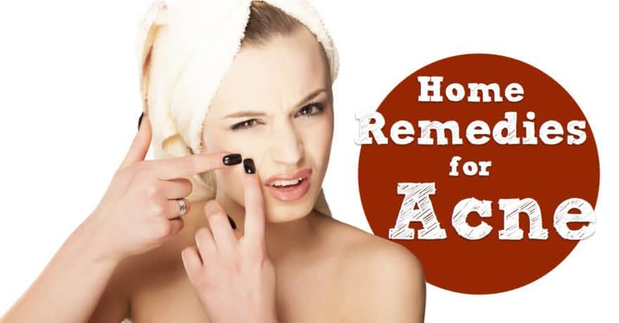 Home Remedies and Natural Cures for Acne